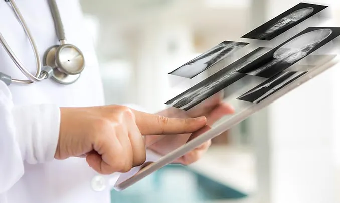 Vivinter mutuelle santé tarif, remboursement, avis